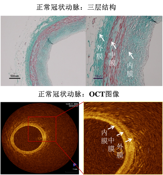 CCEC·前沿技术｜当人工智能“预见”OCT - 知乎