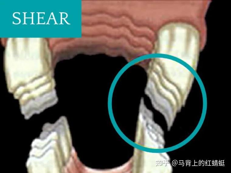 【科普】马牙齿的命名系统-Triadan Tooth Numbering System - 知乎