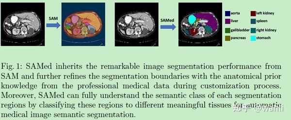 Customized Segment Anything Model for Medical Image Segmentation(SAMed ...