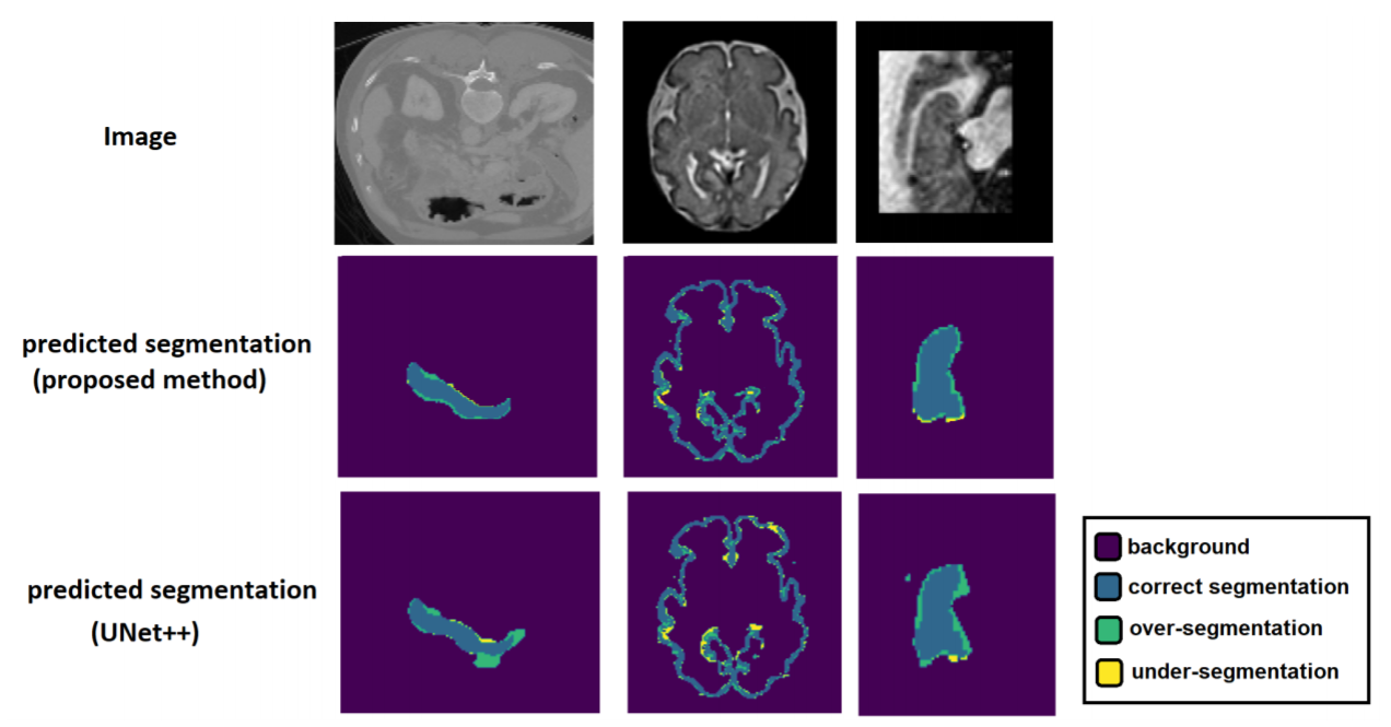 【论文速递11-30】医学图像分割方向优质的论文及其代码 - 知乎