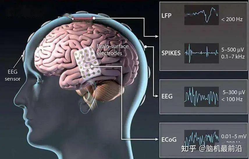 脑机接口：Neuralink的突破与中国非侵入式技术的崛起 - 知乎