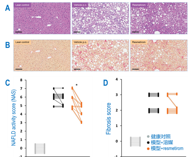 体内药理药效 | Resmetirom三期临床试验、THR-β及NASH新药临床前动物药效测试 - 知乎