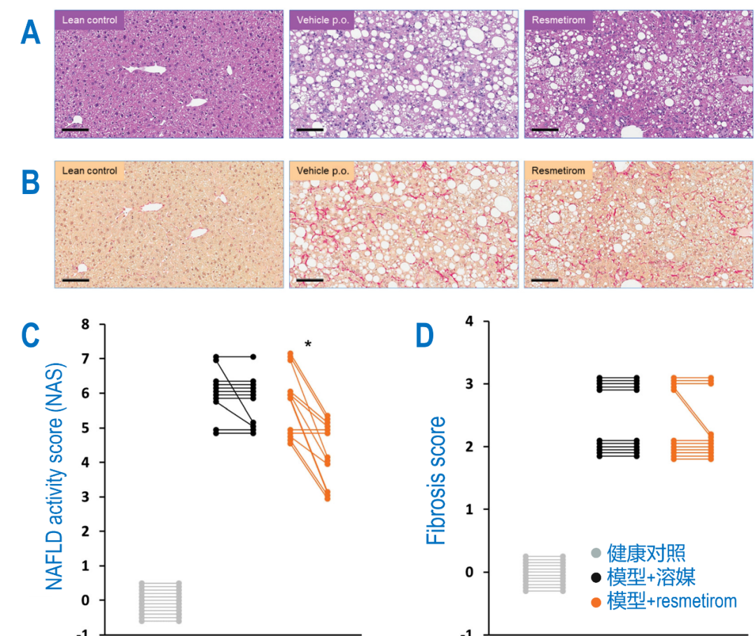 体内药理药效 | Resmetirom三期临床试验、THR-β及NASH新药临床前动物药效测试 - 知乎