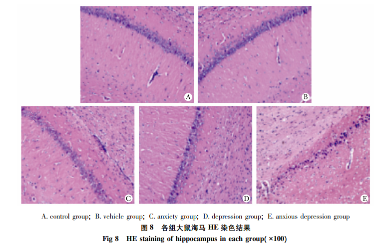 焦虑抑郁模型丨高架十字迷宫、旷场实验、强迫游泳实验综合施行-下 - 知乎
