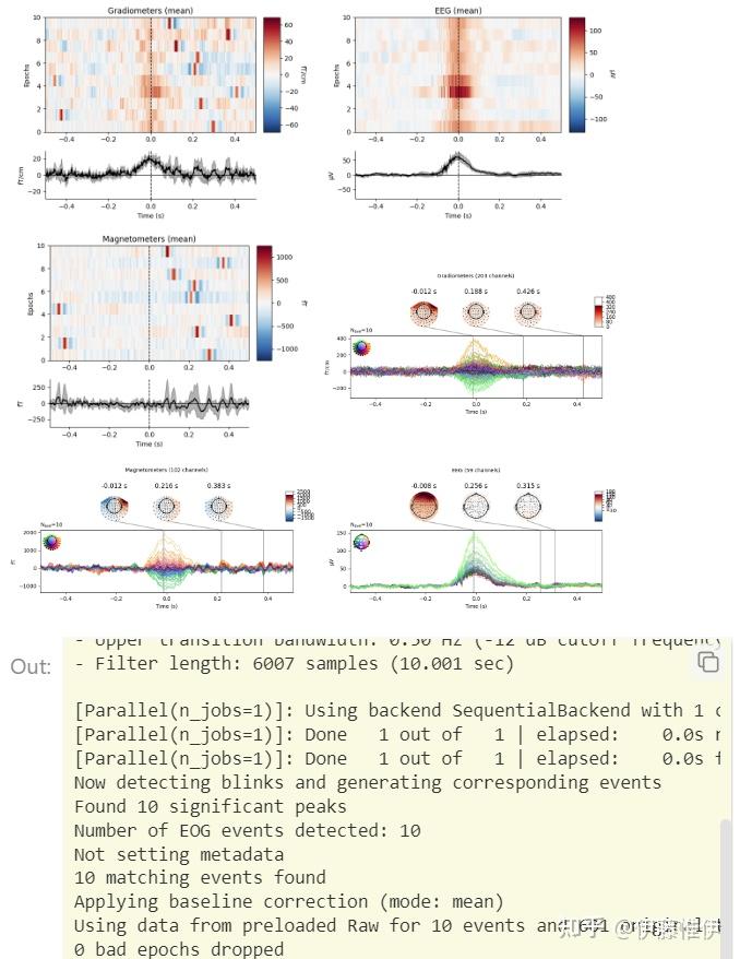 preprocessing——artifact detection - 知乎