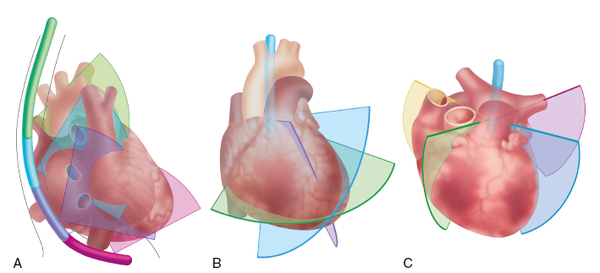 一文读懂 | 心血管检查技术：经食管超声心动图 - 知乎