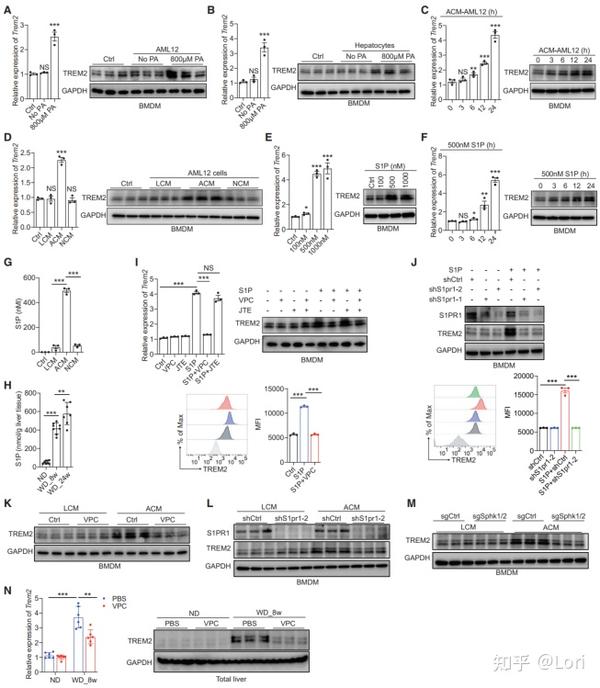 文献学习002——TREM2 依赖的胞葬调控肝脏炎症和NASH发展 - 知乎