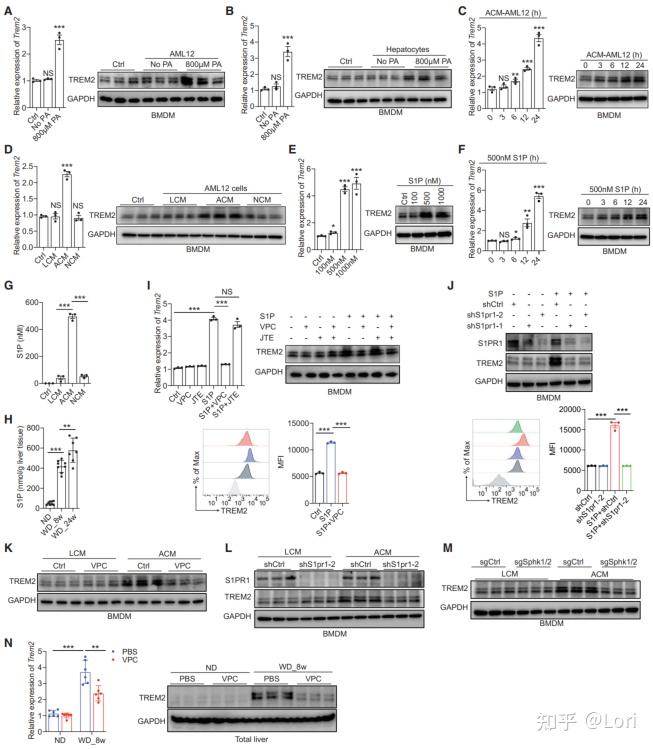 文献学习002——TREM2 依赖的胞葬调控肝脏炎症和NASH发展 - 知乎