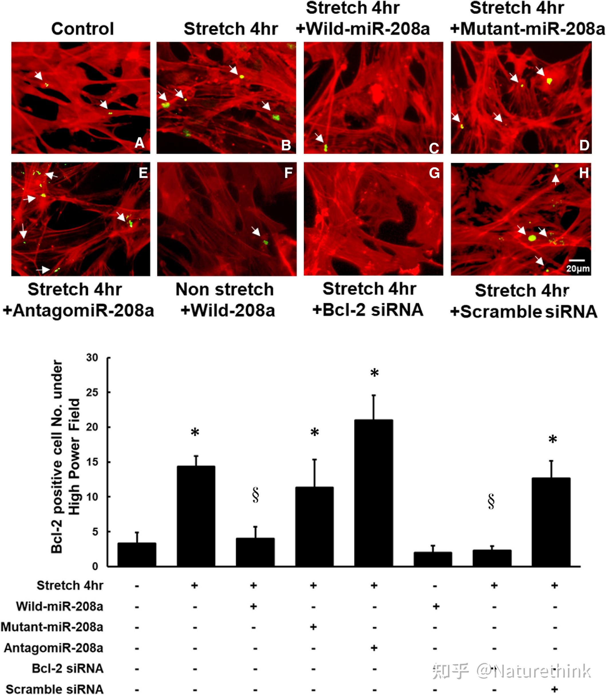 循环拉伸通过心房成纤维细胞中的 microRNA-208a 促进 microRNA-499 调节 Bcl-2 - 知乎