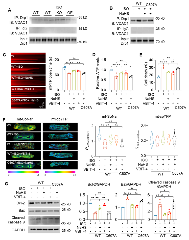 Redox Biol︱呼庆勋课题组发现半胱氨酸γ裂解酶硫巯基化Drp1改善心功能紊乱 - 知乎