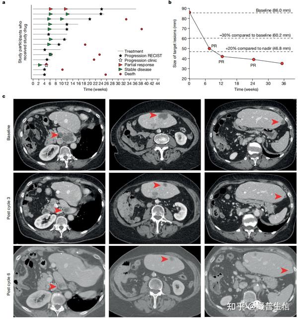 Netrin-1阻断能抑制子宫内膜癌的肿瘤生长和EMT特征 - 知乎