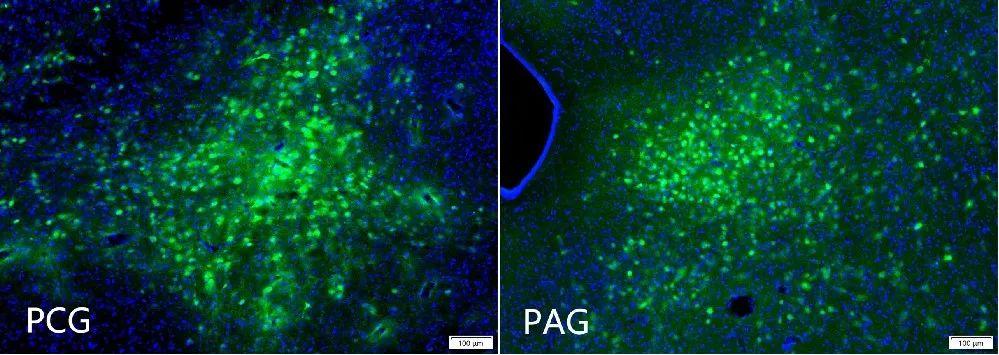小布tips | 外周PRV示踪-快，准，亮！你想要的都在这！ - 知乎
