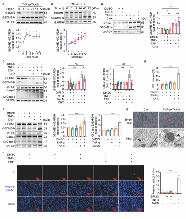 Cell Death Discov︱福医大附院谢良地团队揭示肌少症中TNF-α调控骨骼肌细胞发生细胞焦亡的分子机制 - 知乎