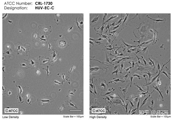 HUVEC细胞培养攻略 - 知乎