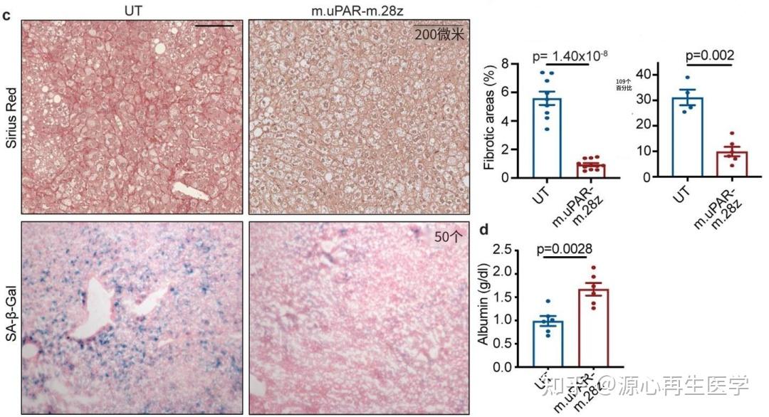 Nature丨“返老还童”新突破：uPAR助力CAR-T提高抗衰老效果 - 知乎
