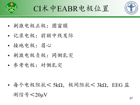 临床听力学技术专业沙龙｜人工耳蜗植入术中及术后EABR的应用 - 知乎