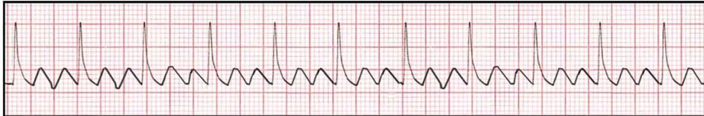 每日一题---护士执业考试（NCLEX-RN) - 知乎