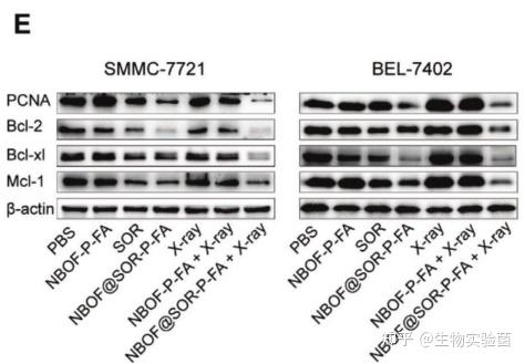 Western Blot 原理及基础应用 - 知乎