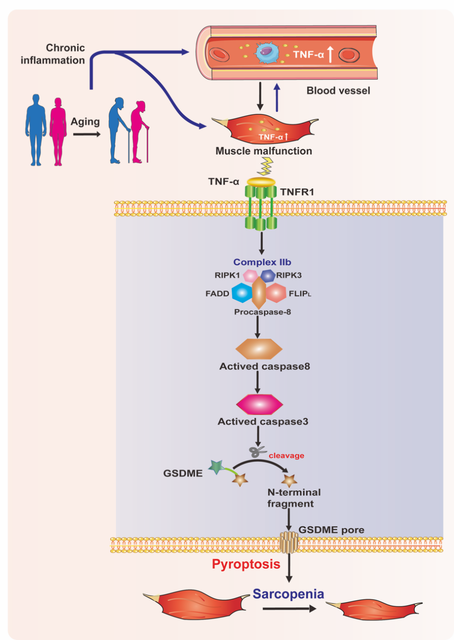 Cell Death Discov︱福医大附院谢良地团队揭示肌少症中TNF-α调控骨骼肌细胞发生细胞焦亡的分子机制 - 知乎