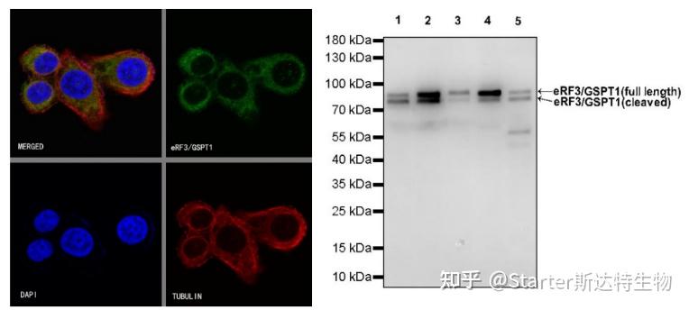 揭秘GSPT1：肿瘤治疗的黄金靶点 - 知乎