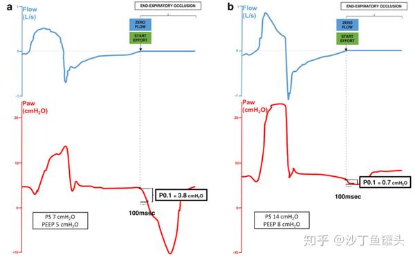 机械通气呼吸驱动监测：肺和膈肌保护性通气 - 知乎