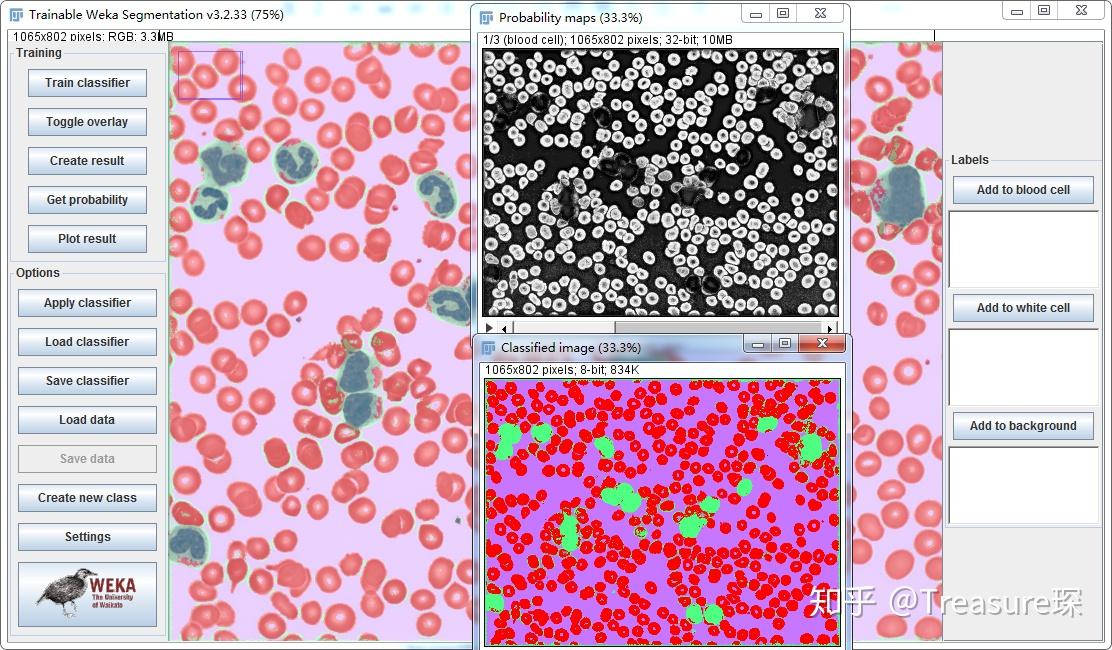 ImageJ实用技巧——细胞计数综述 - 知乎