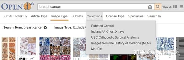 SCI写作-利用NCBI下的网页OPENI进行图片检索，制作高大上的流程图，反向检索文献 - 知乎