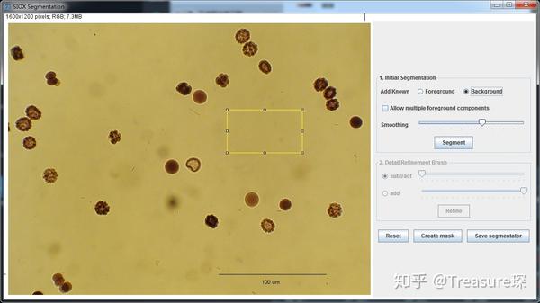 ImageJ实用技巧——快速区域选取(基础功能篇) - 知乎