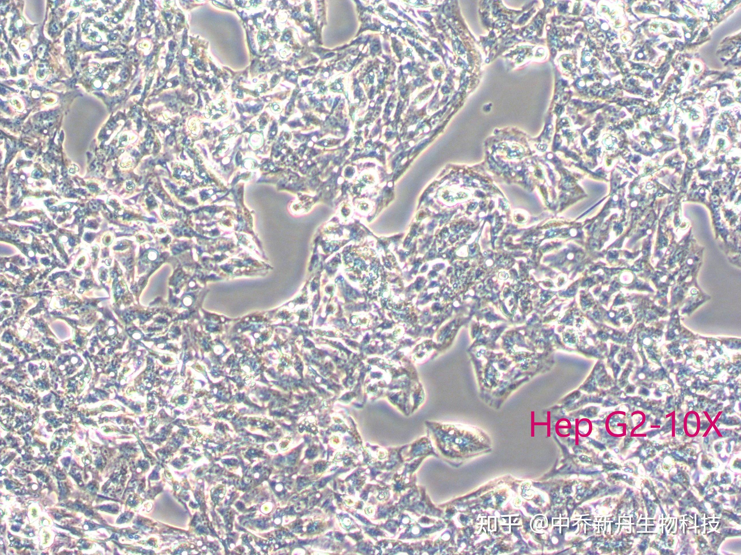 Hep G2细胞培养方法和复苏技术 - 知乎
