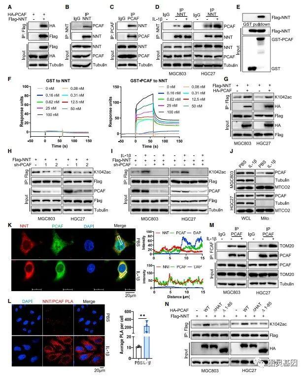 Mol Cell | 中山大学肿瘤医院徐瑞华团队发现 IL-1β诱导铁死亡机制 - 知乎