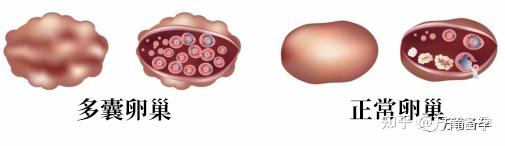 女性AMH正常值范围是多少？ 教你看懂AMH检查报告！ - 知乎