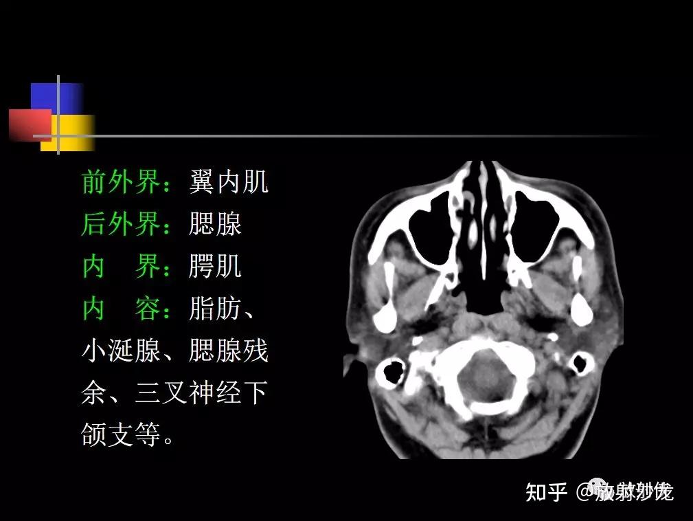 收藏必备 鼻咽部的ct详细解剖 知乎