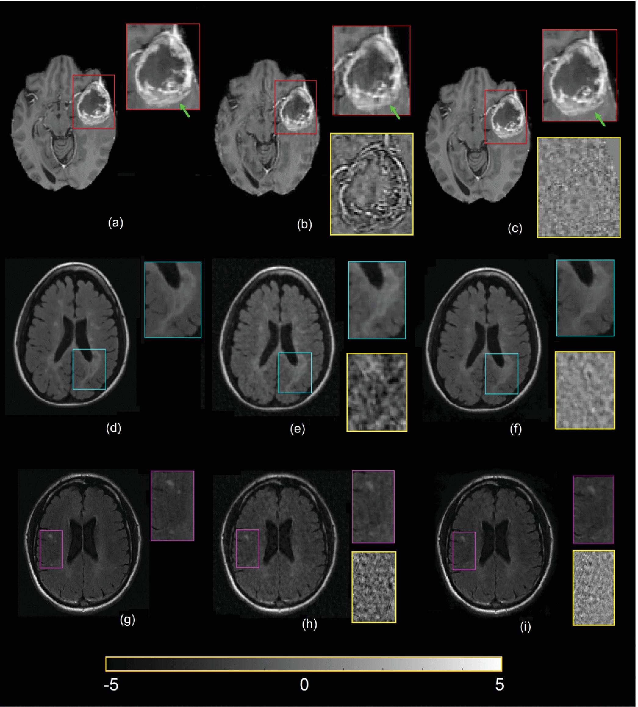 DAGAN: DAGAN for Fast CS-MRI Reconstruction - 知乎