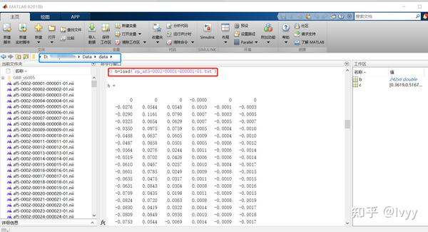 SPM数据预处理 -单被试 - 知乎