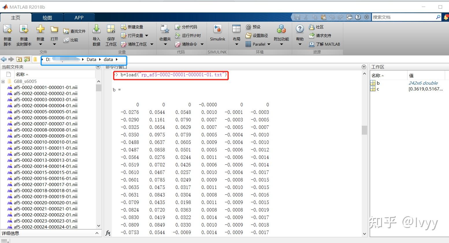 SPM数据预处理 -单被试 - 知乎