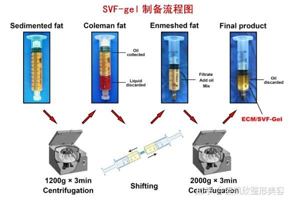2021年SVF-GEL 南方医院学术会议笔记 - 知乎