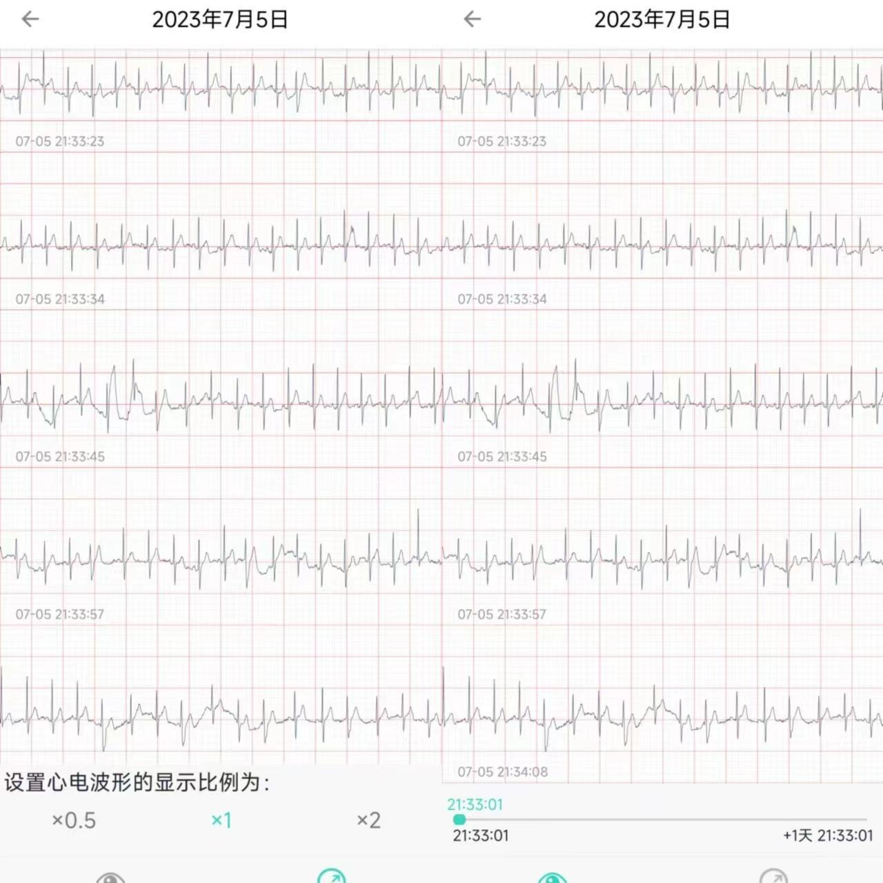 健康｜心脏问题需早发现早治疗，如何及时发现？乐普ER1有答案！ - 知乎