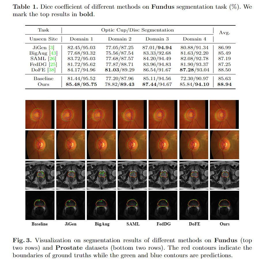ECCV 2022 | 南大&东南大学新作RAM-DSIR：通过随机振幅混合和特定领域的图像重建实现可推广的医学图像分割 - 知乎