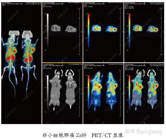 小动物PET/CT在肿瘤模型及疗效评价方面的应用 - 知乎