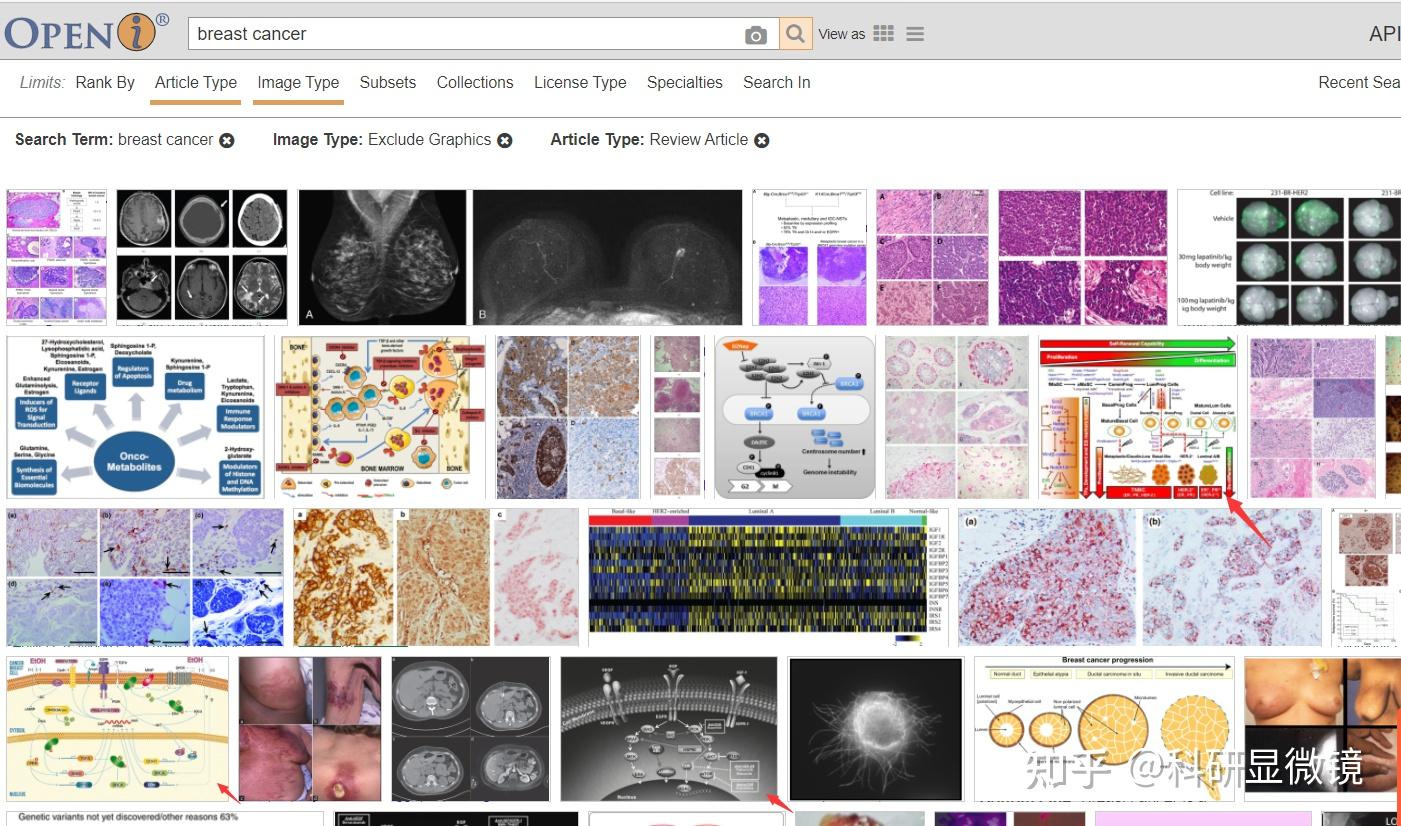 SCI写作-利用NCBI下的网页OPENI进行图片检索，制作高大上的流程图，反向检索文献 - 知乎