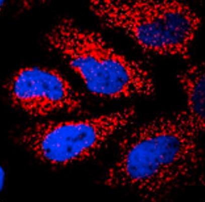 Mol Cell | 中山大学肿瘤医院徐瑞华团队发现 IL-1β诱导铁死亡机制 - 知乎