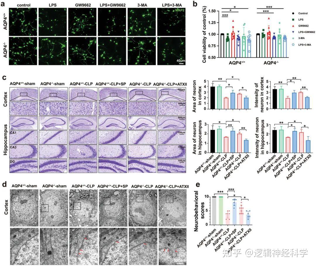 Adv Sci︱大连医科大学李韶课题组揭示AQP4通过抑制Nav1.6介导的星形胶质细胞自噬加重脓毒症相关脑病认知障碍 - 知乎