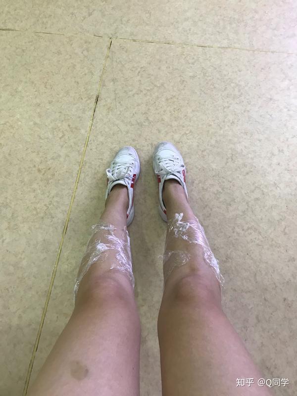 我入了瘦腿针的坑 知乎