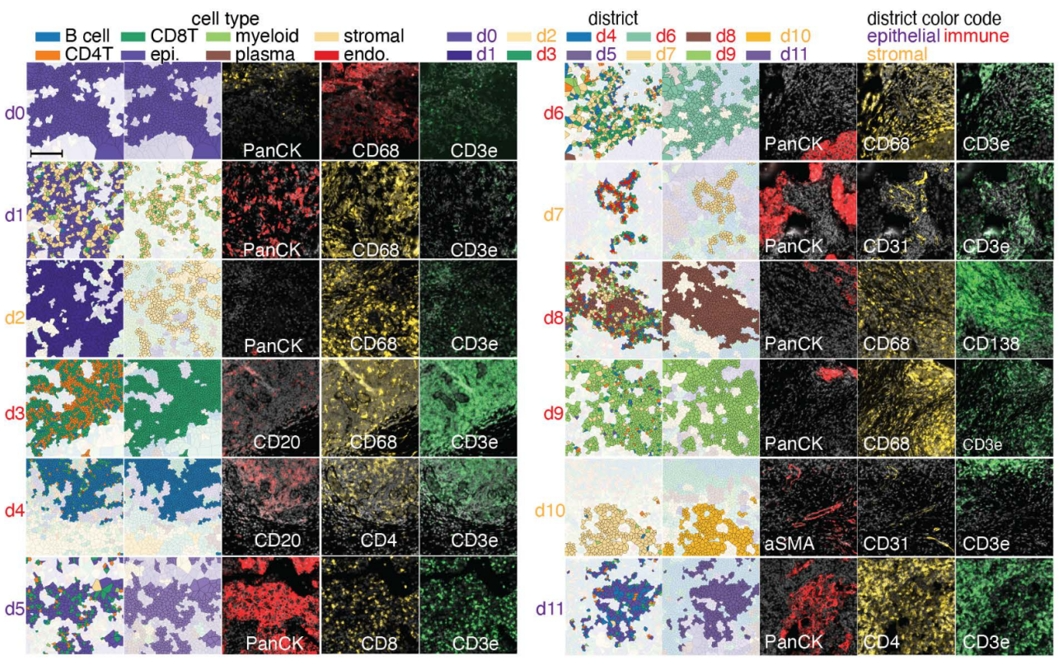 Cancer Cell | PhenoCycler-Fusion空间单细胞蛋白组学（简称PCF,原CODEX）鉴定三阴乳腺癌不同的治疗反应轨迹 - 知乎