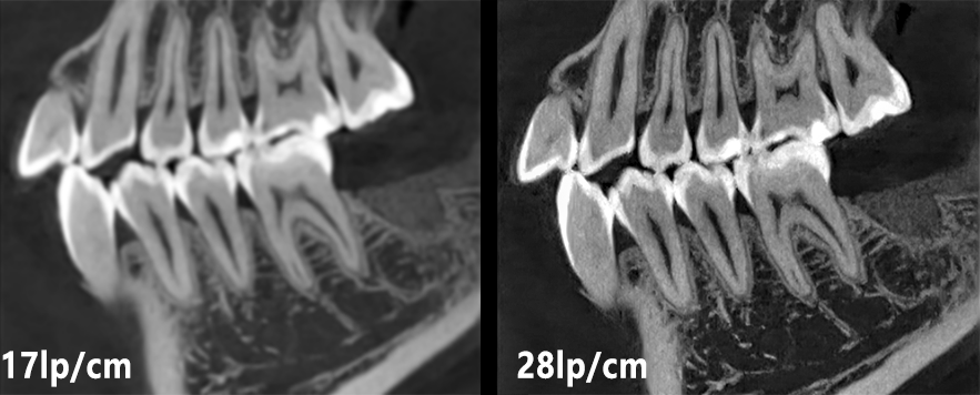 线对vs体素，到底谁决定了CBCT图像清晰度? - 知乎