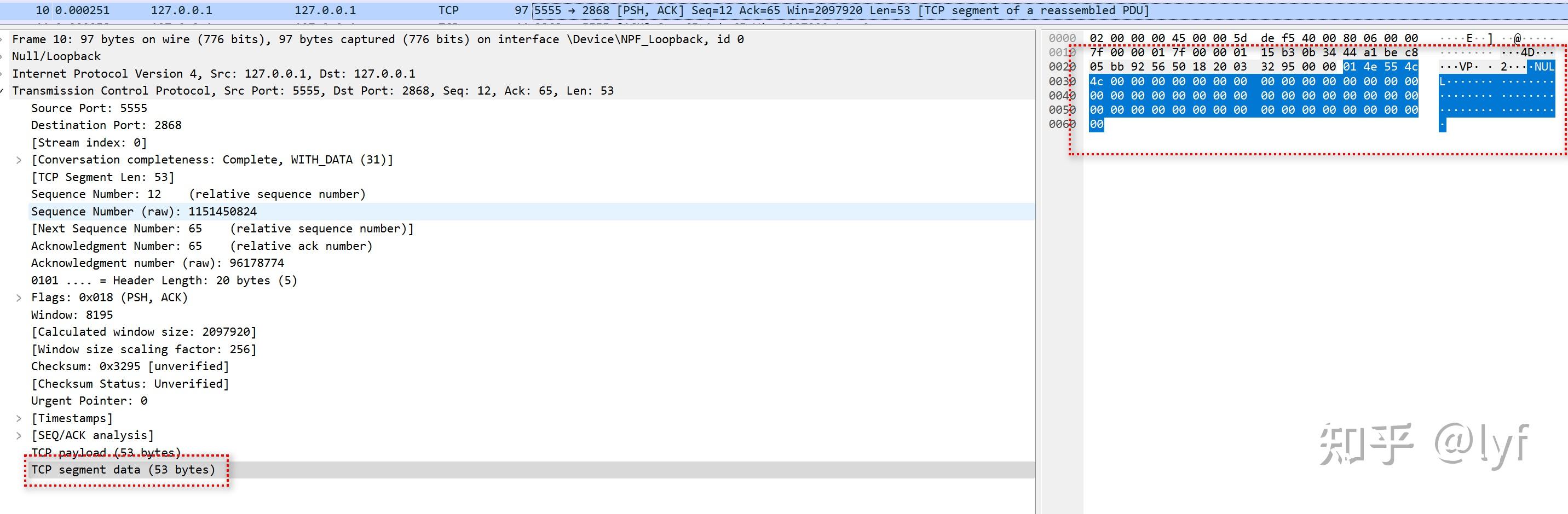 ZeroMQ入门—1. ZeroMQ简介 - 知乎
