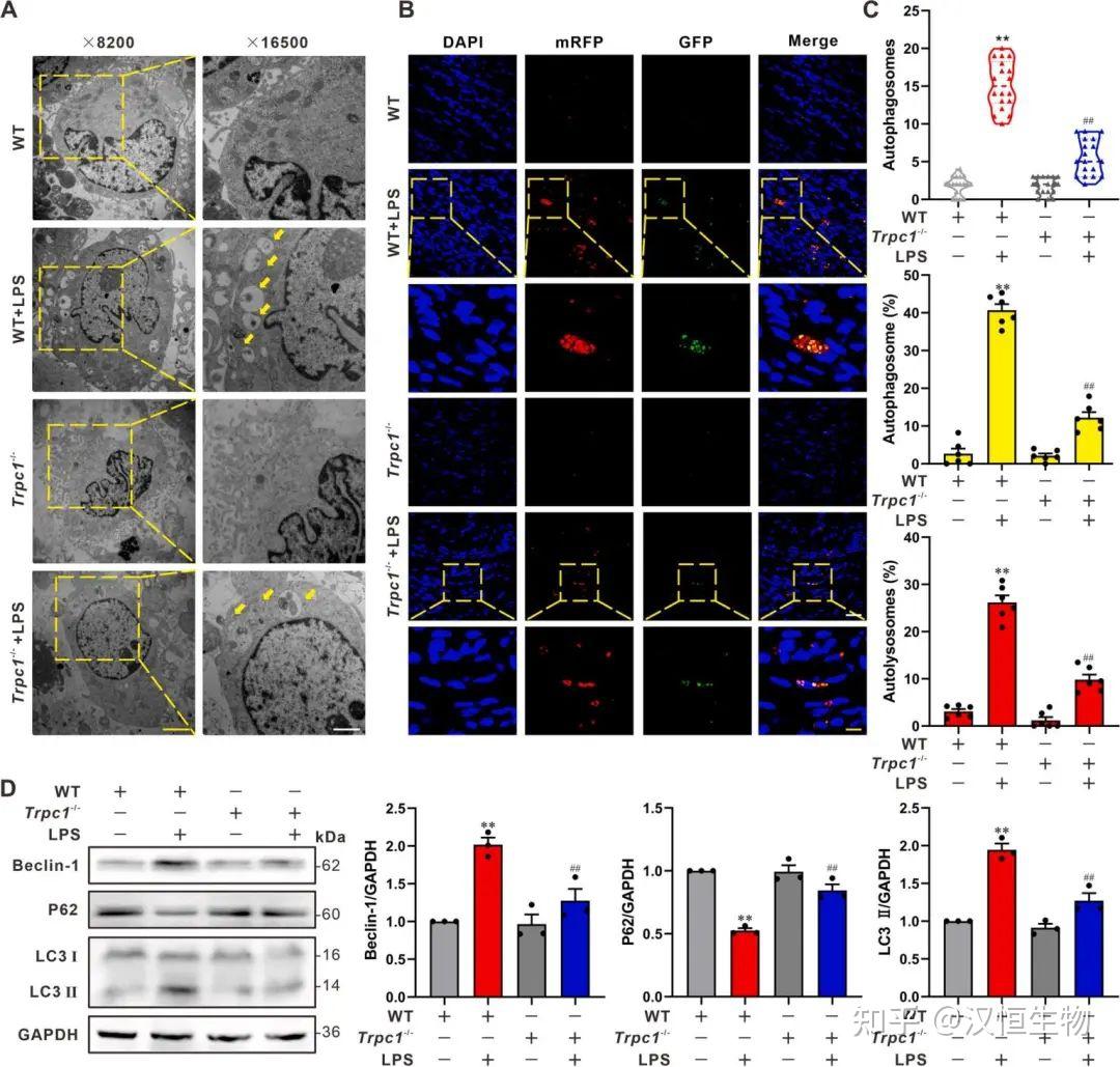 自噬干货分享系列之经典自噬研究 - 知乎