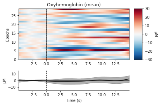 MNE/Python-fNIRS近红外数据处理中文手册 - 知乎