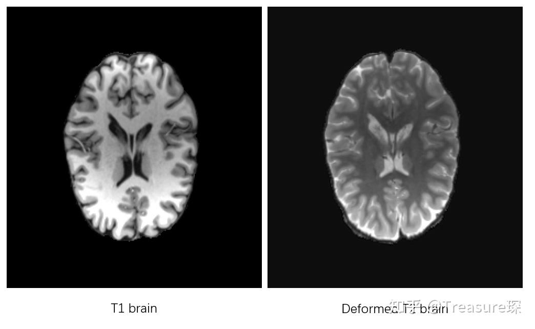 Python科研图像处理——PyElastix非刚性配准 - 知乎