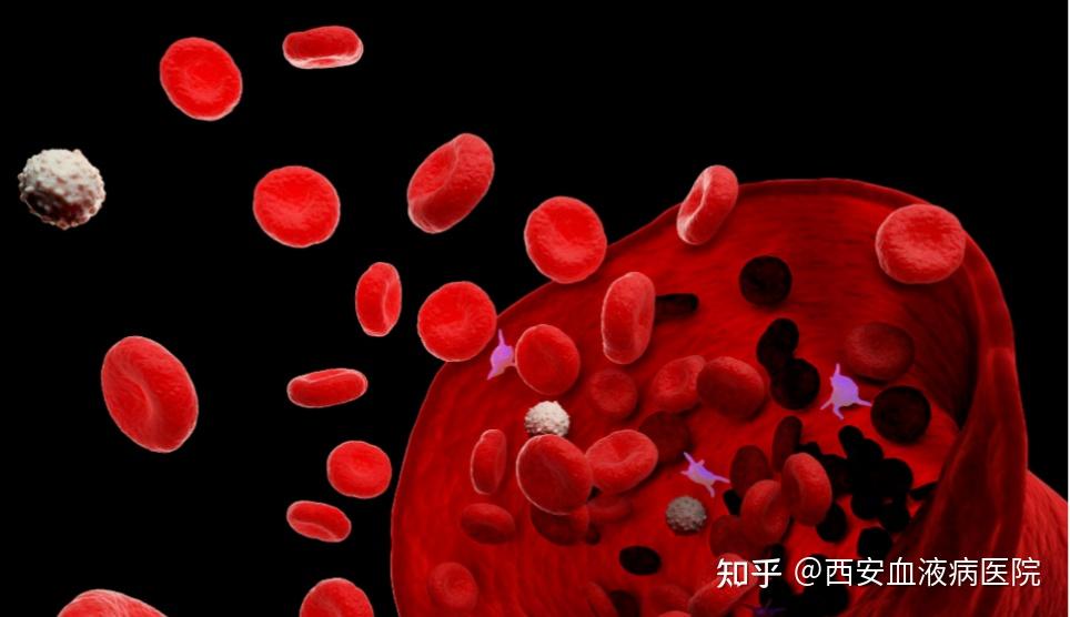 关于原发性血小板减少症(ITP)，你真正了解多少？如何稳定提升？ - 知乎